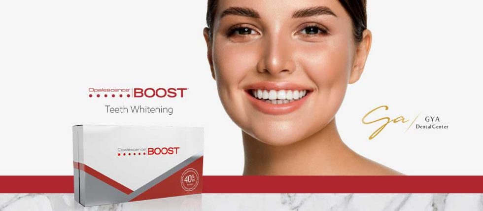Why opalescence teeth whitening boost is unique | GYA Dental Center